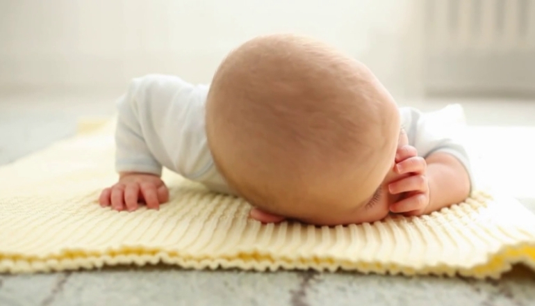 Cradle Cap (Seborrheic Dermatitis in Babies) | Pregnant Life