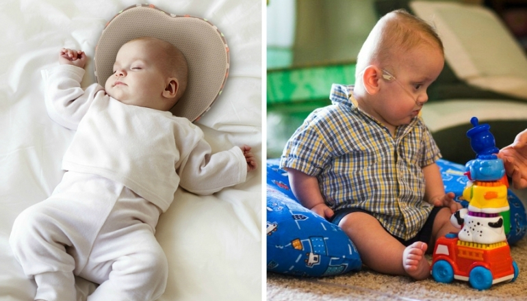 How to Prevent Infant Flat Head Syndrome? | Pregnant Life