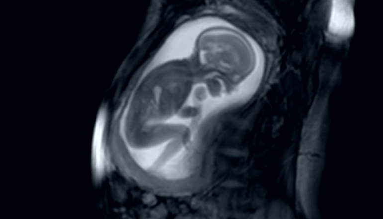 Incredible MRI Scan Shows Baby Moving in the Womb | Pregnant Life