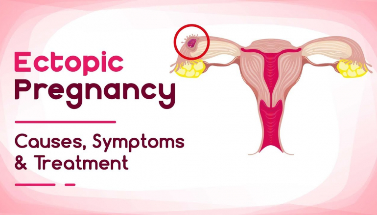 Ectopic Pregnancy - Reasons, Symptoms and Treatment | Pregnant Life