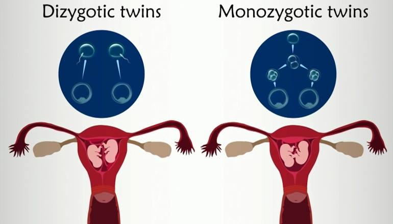 What is Multiple Pregnancy? | Pregnant Life